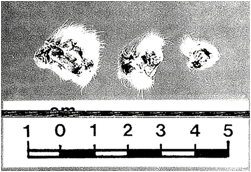 Promethazine (Phenergan) Cancer Treatment - Dr. Robert Jones - Background